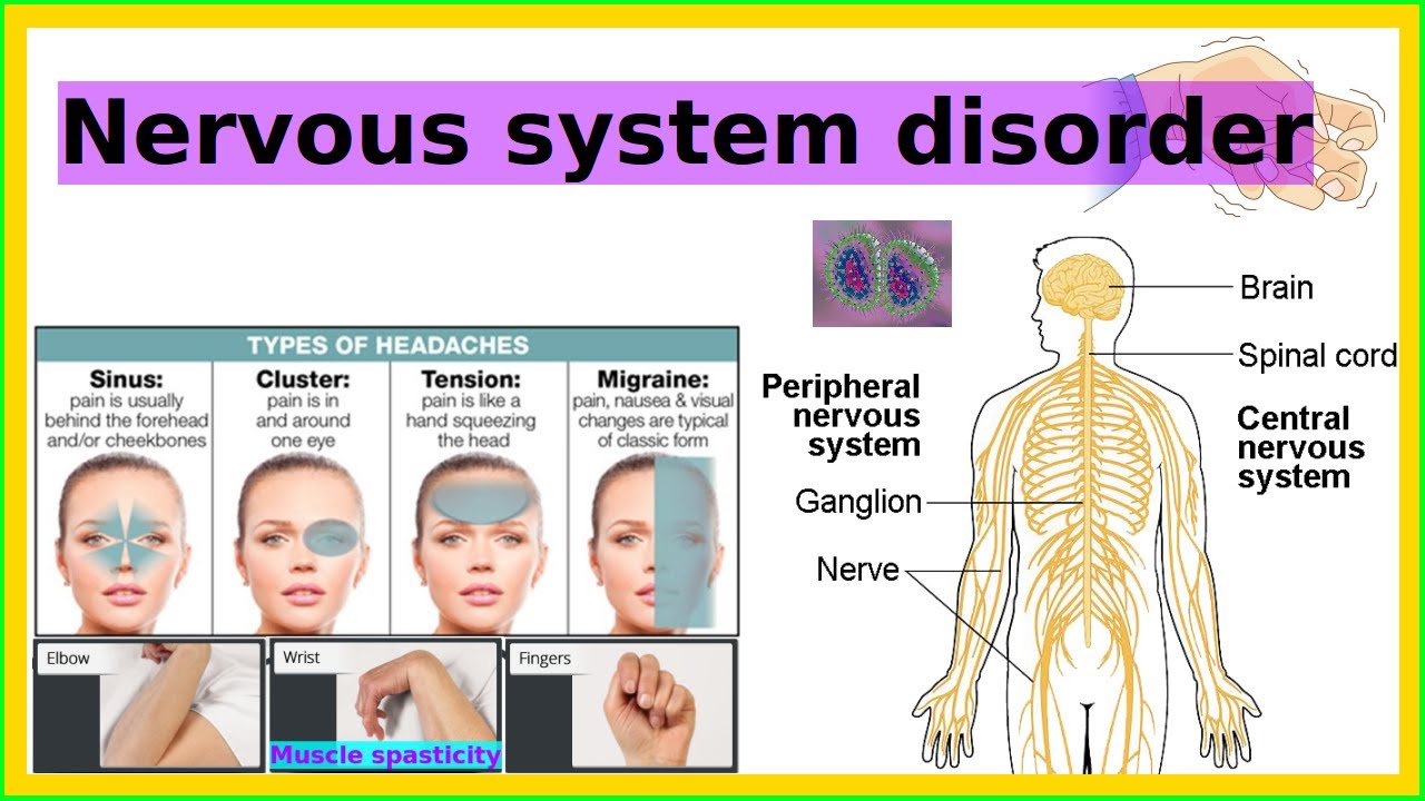 Nervous System Disorder YouTube