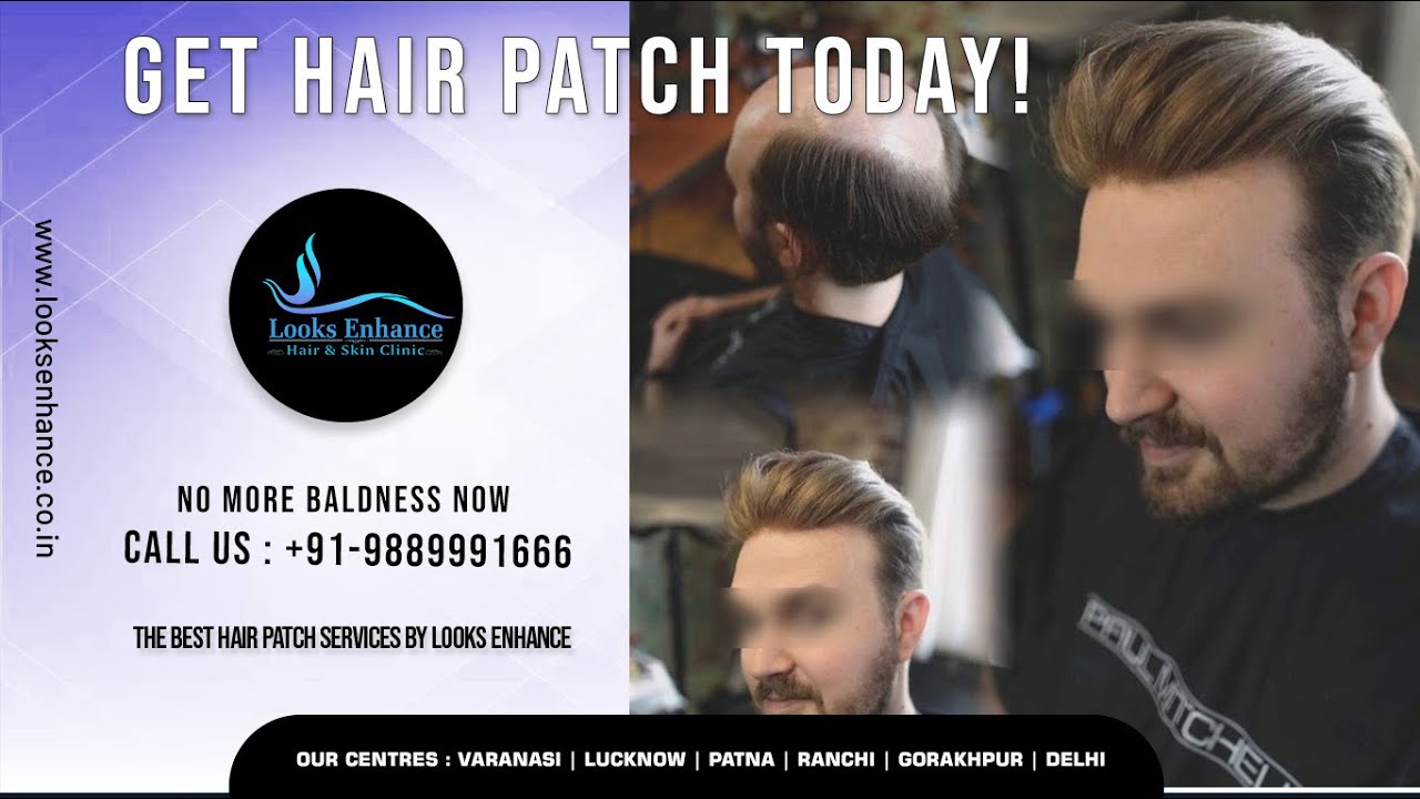 Top Hair Weaving Services in Patna | Men's Hair Patch | Mens hair patch ...