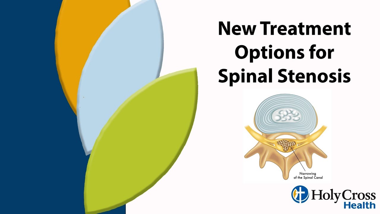 Dr. William Porter McRoberts Discusses Spinal Stenosis: Causes ...