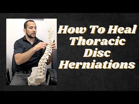 How To Treat Herniated Disc In Thoracic Spine
