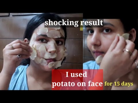 I used potato on my face for 15 days so what it happen / shocking ...