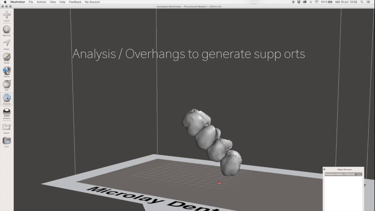 Microlay DentalFab | Preparing Bridges or Crowns for 3D Printer with ...