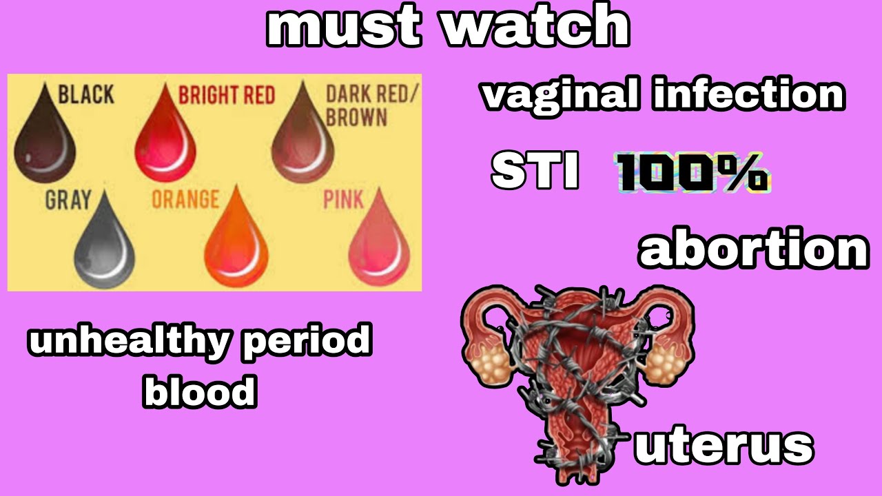 kya apka period blood dangerous hai || which type of period blood is ...