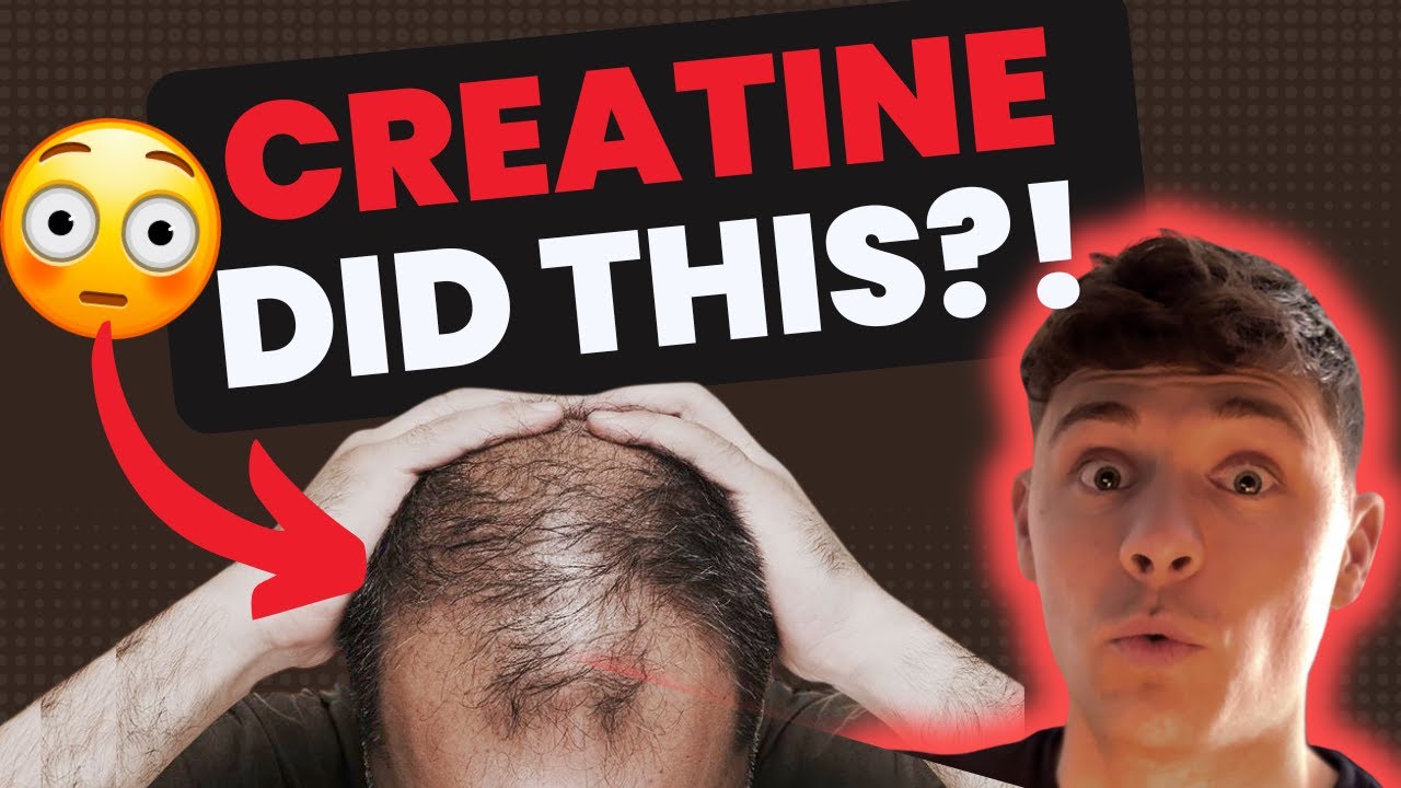 Researcher Explains: Creatine Hair Loss - YouTube