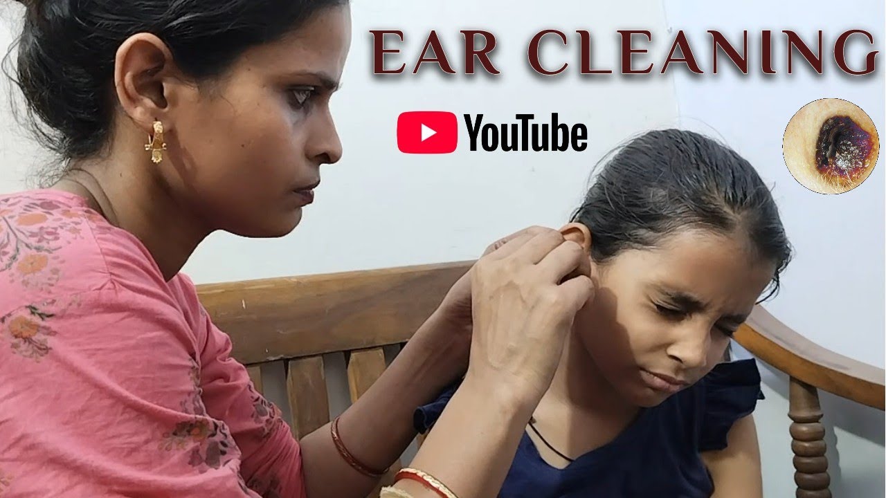 Deep Ear Cleaning of Little Girl 👧🧼 | Super Satisfying Earwax Removal ...