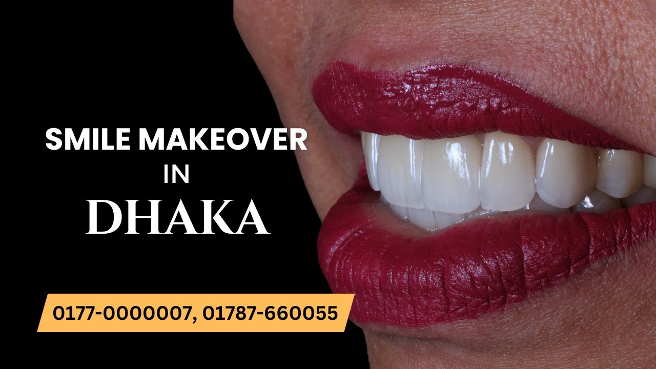 Digital Smile Makeover in Dhaka | Step by Step at LASER DENTAL - YouTube