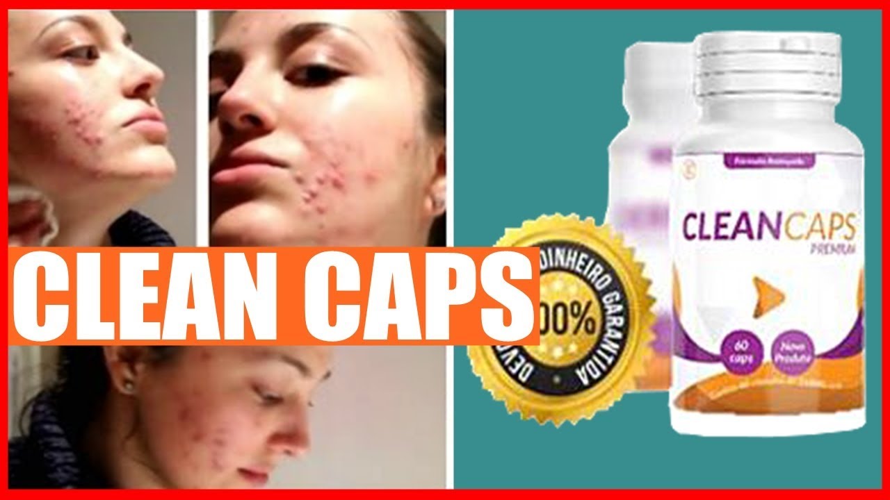 💊 😁 CLEAN CAPS Comprar com (DESCONTO) o CLEAN CAPS para ACNE ...