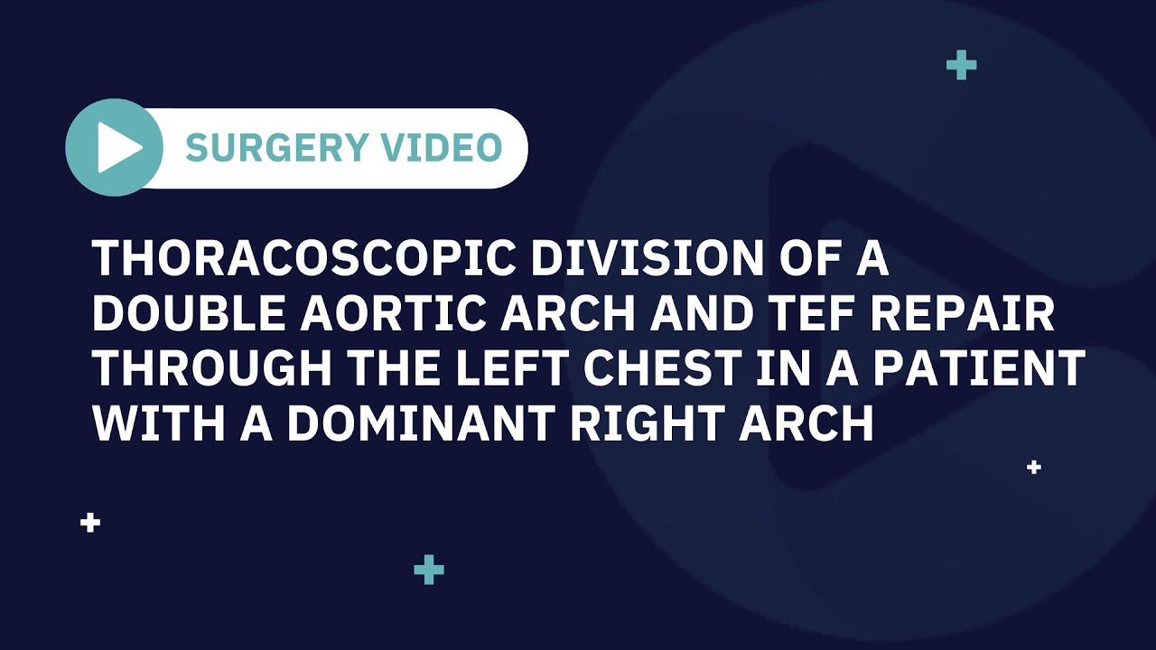 Surgery Video: Thoracoscopic Division Of A Double Aortic Arch And Tef ...