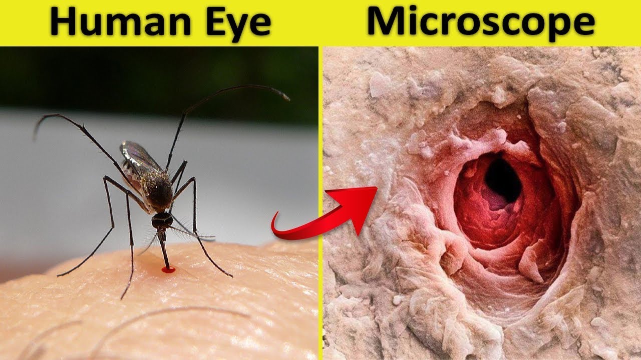 Things You Can See Only Under Microscope In Urdu Hindi - YouTube Things You Can See Only Under Microscope In Urdu Hindi - YouTube