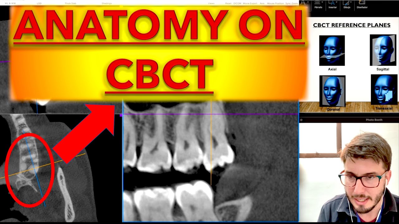 3D Head & Neck Anatomy for Dental students: CBCT x ray, TMJ, Jaw, Mandible, Skull Bones, INBDE ...