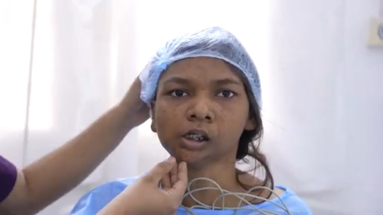Temporomandibular Joint (TMJ) Surgery for a Young Girl - Before and ...