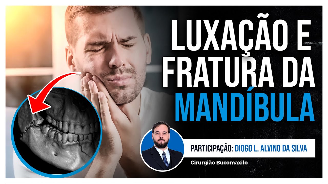 MANDÍBULA | LUXAÇÃO E FRATURA | DICAS PRÁTICAS - YouTube