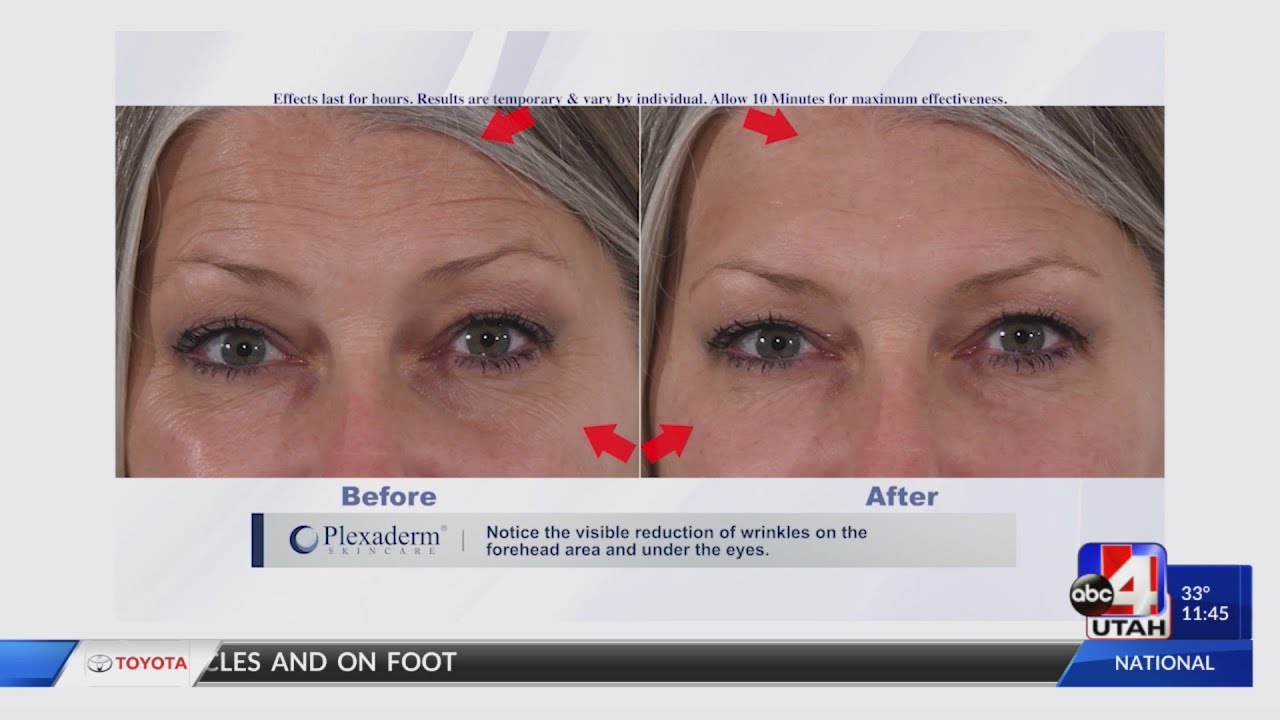 The answer to your skin problems - YouTube