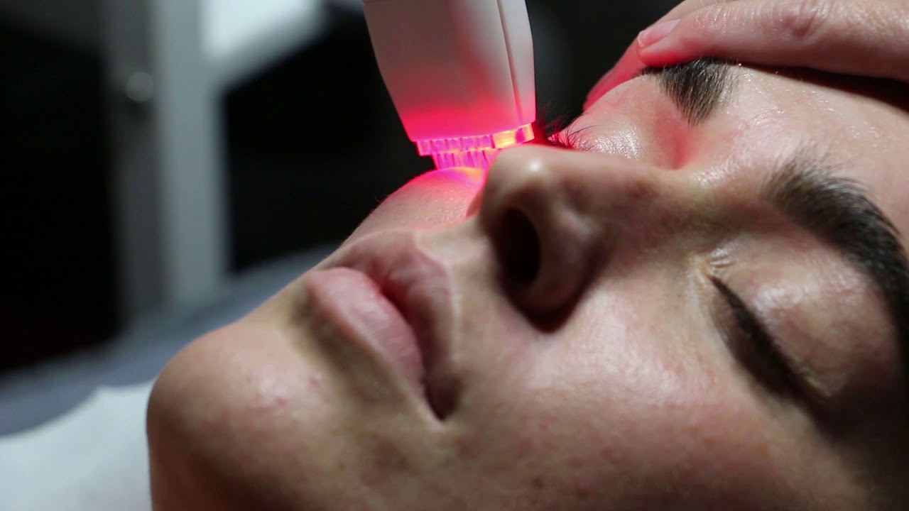 ANGEL CLINIC CACI Wrinkle Comb - YouTube