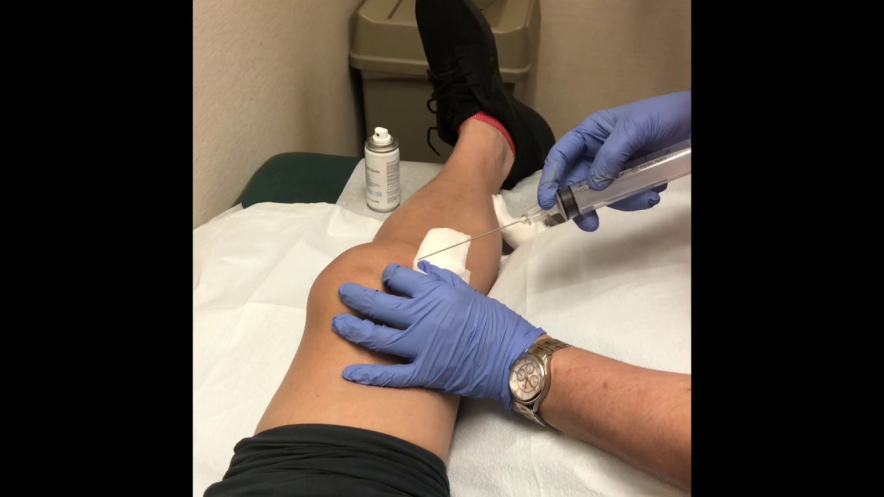 Knee draining - YouTube