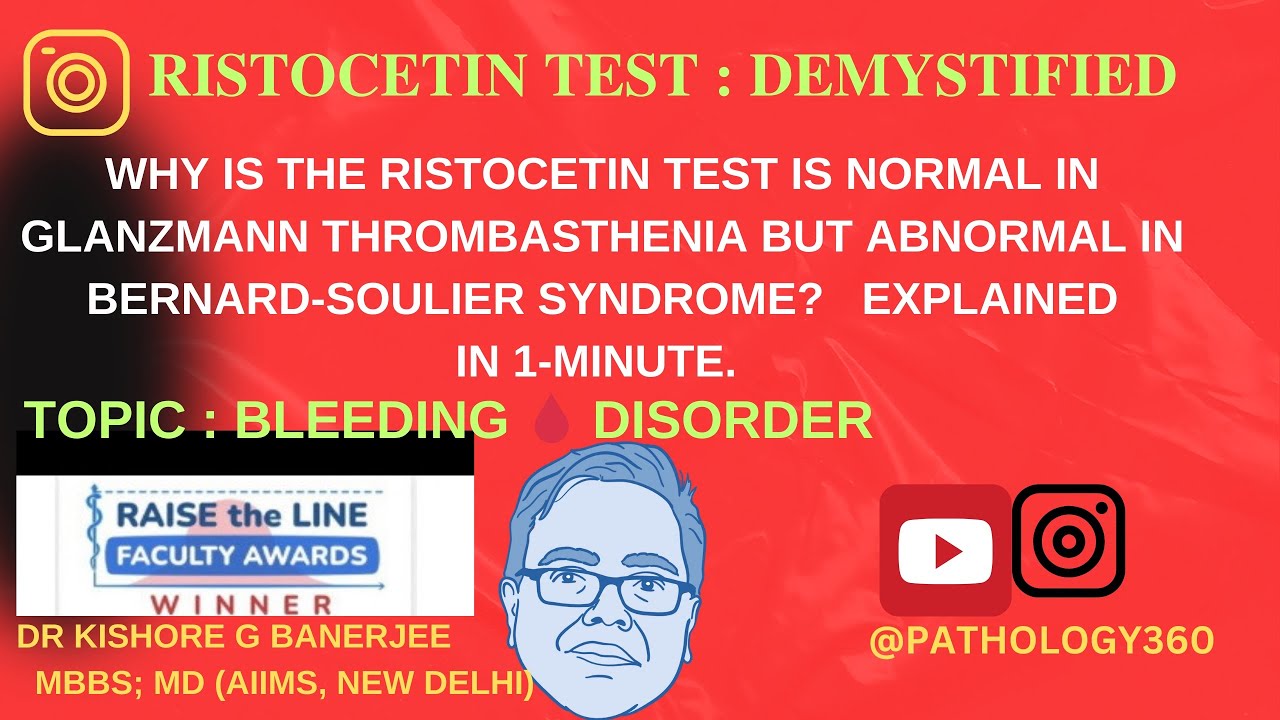 WHY Ristocetin Test Normal in Glanzmann Thrombasthenia; BUT, abnormal ...
