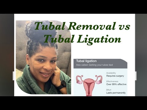 I had my tubes REMOVED! Tubal Removal vs Tubal Ligation - YouTube