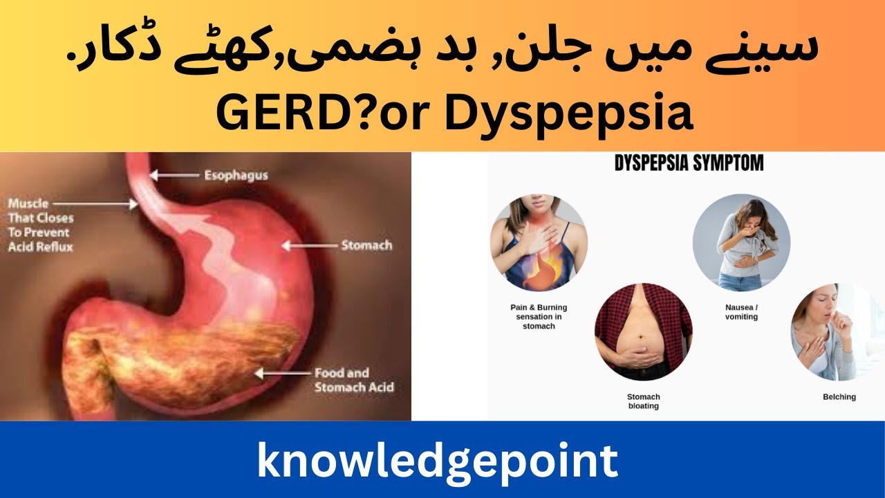 Understanding Abdominal pain |Epigastric pain Gas |Bloating |Gerd or ...