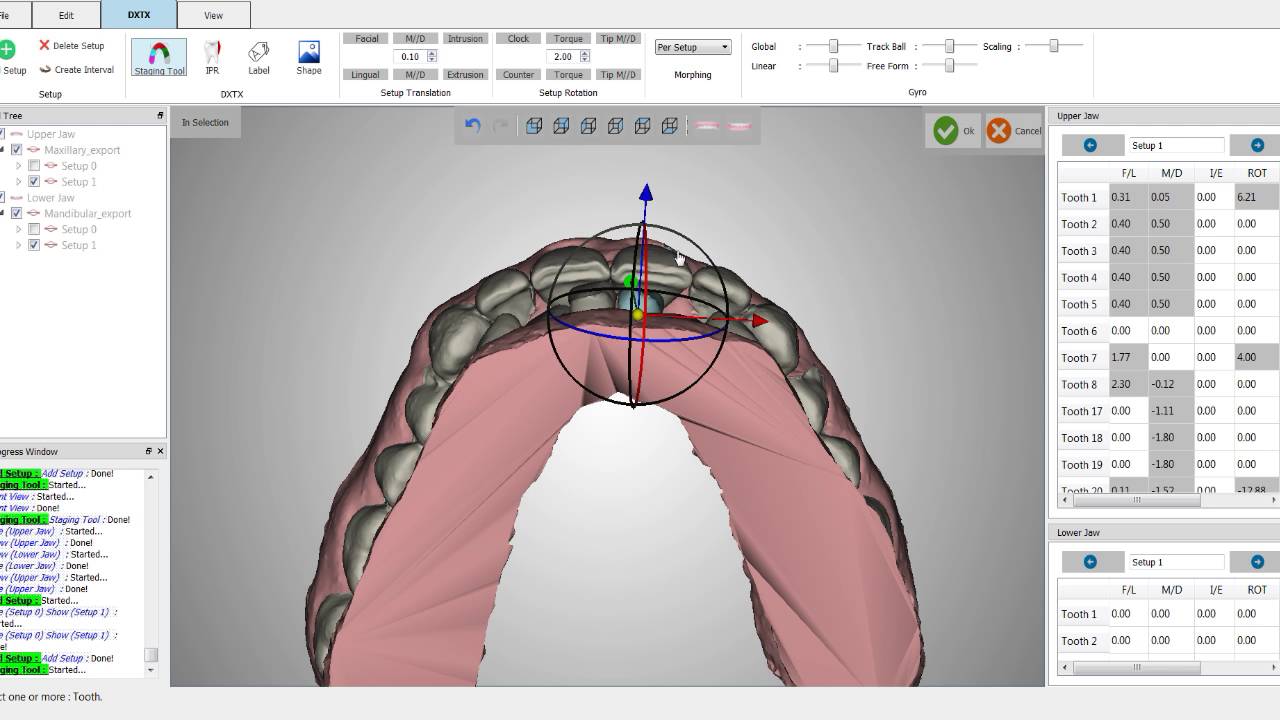 O3D 3.0 Practice Case 3 - Moderate Crowding - YouTube