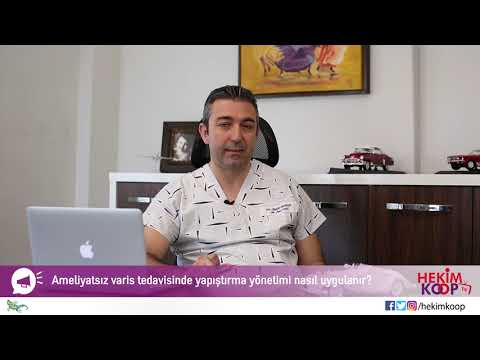 Ameliyatsız Varis Tedavisinde Yapıştırma Yönetimi Nasıl Uygulanır?