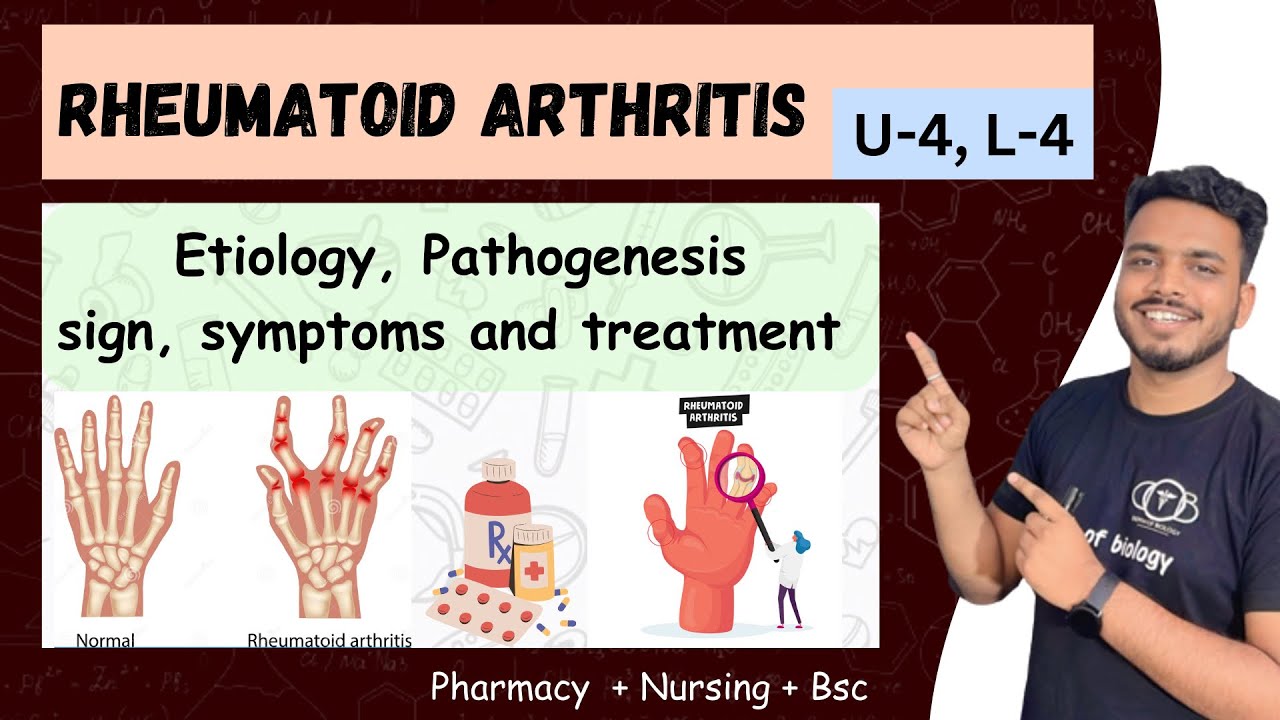 Rheumatoid Arthritis Rheumatoid Arthritis Pathophysiology rheumatoid-arthritis-rheumatoid-arthritis-pathophysiology
