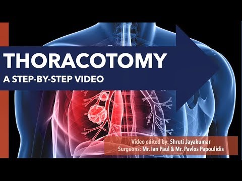 CTSNet Step-by-Step Series: Posterolateral Thoracotomy - YouTube