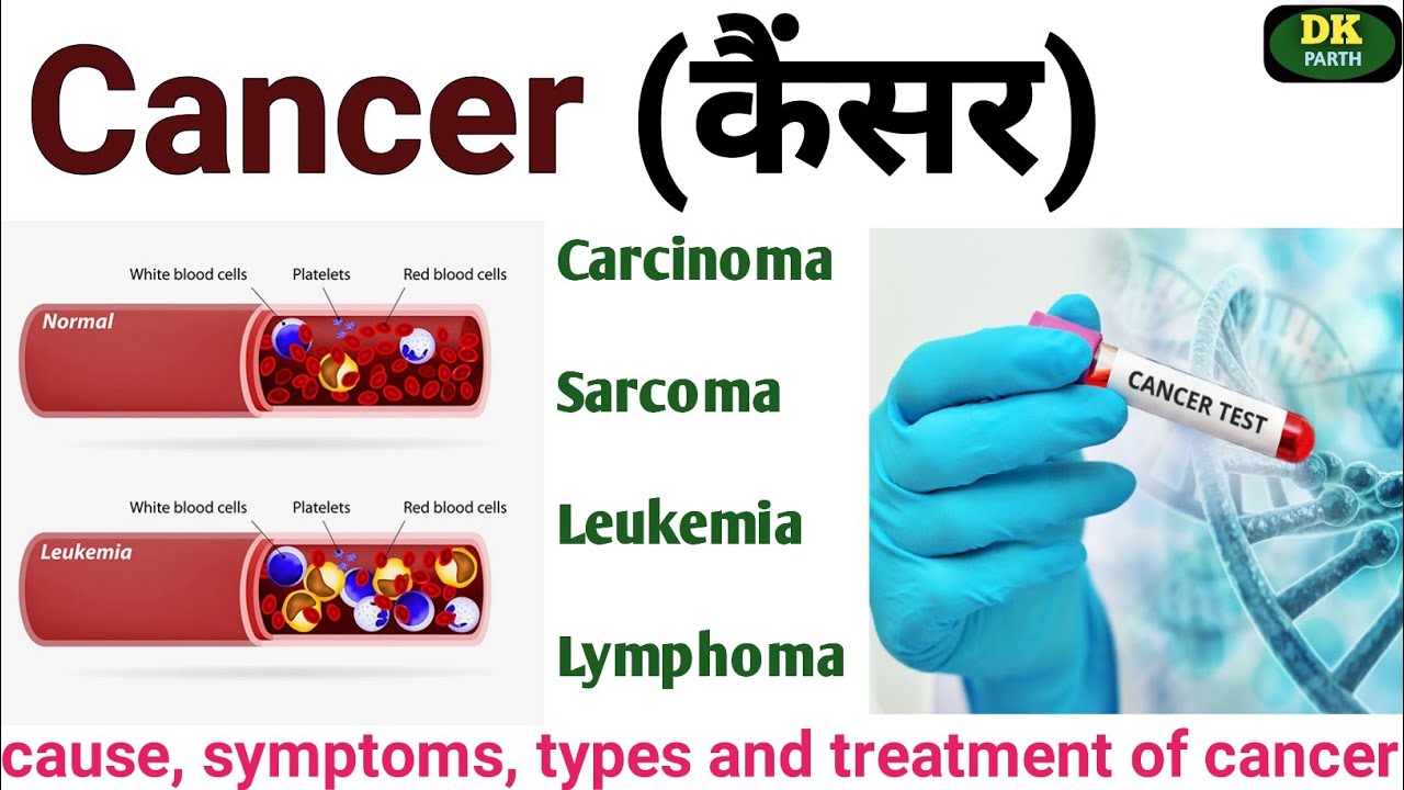 Cancer (कैंसर)। Cancer in hindi। Symptoms of cancer। Types of cancer ...