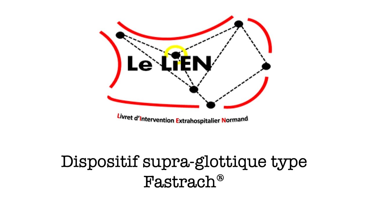 Masque Laryngé - Fastrach® - Le LIEN vidéo - YouTube