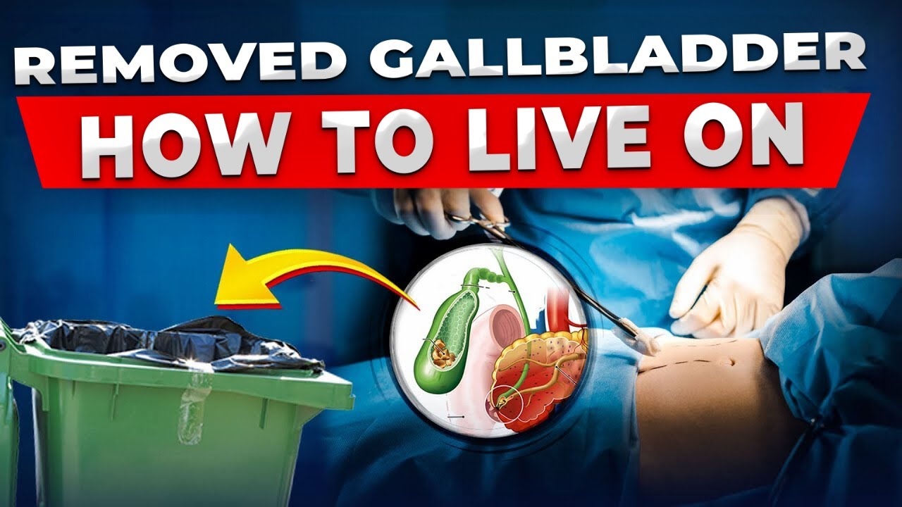 Post–gallbladder removal recovery algorithm — the 3 essential rules you ...