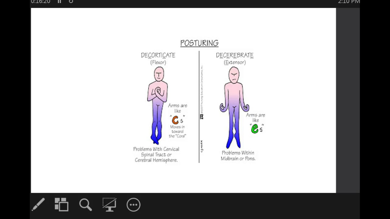 Acute Intracranial Problems - YouTube