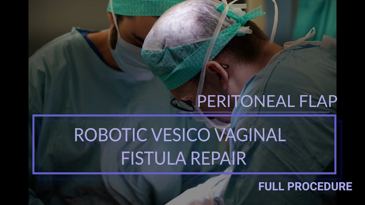 Robotic (Da Vinci) Vesicovaginal Fistula Repair / Full Procedure - YouTube