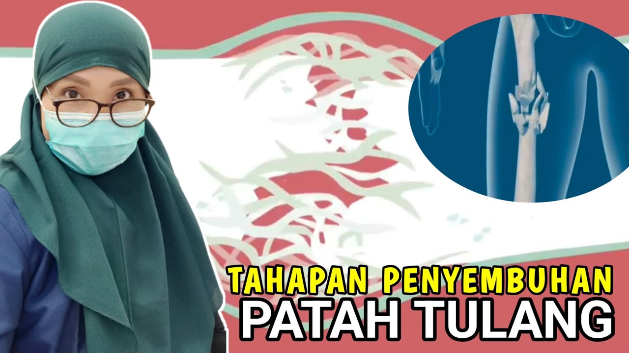 tahapan penyembuhan patah tulang || Patah tulang bisa Sembuh sendiri ...