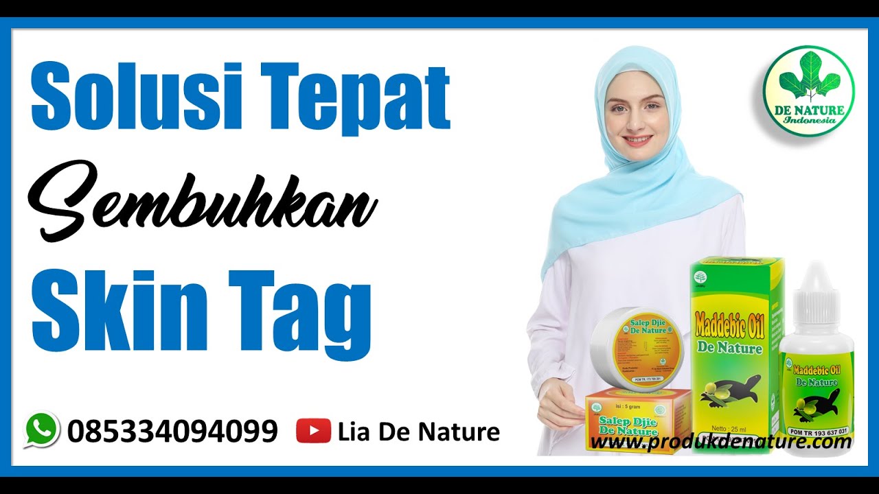 OBAT SKIN TAG DI APOTIK - CARA MENGHILANGKAN SKIN TAG / DAGING TUMBUH ...