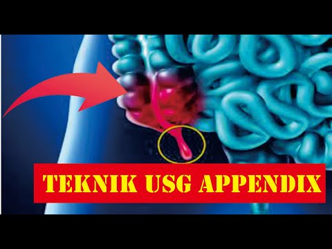 TEKNIK USG APPENDIX - YouTube