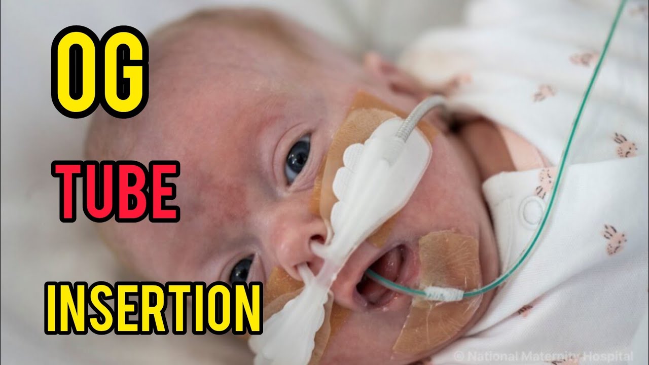Orogastric (og) Tube Insertion Procedure | How To Insert Orogastric ...