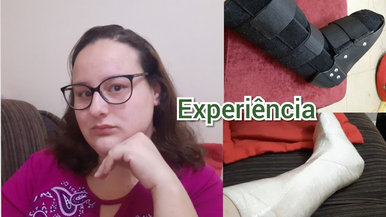 MINHA EXPERIÊNCIA COM A TALA DE GESSO E A ROBOFOOT - BY GISLAINE ...