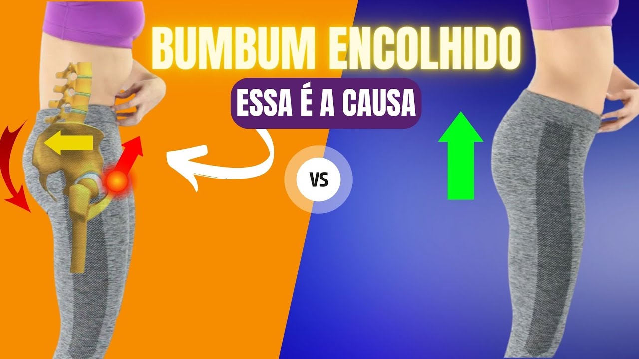 EMPINE O BUMBUM COM UMA SIMPLES CORREÇÃO POSTURAL - YouTube
