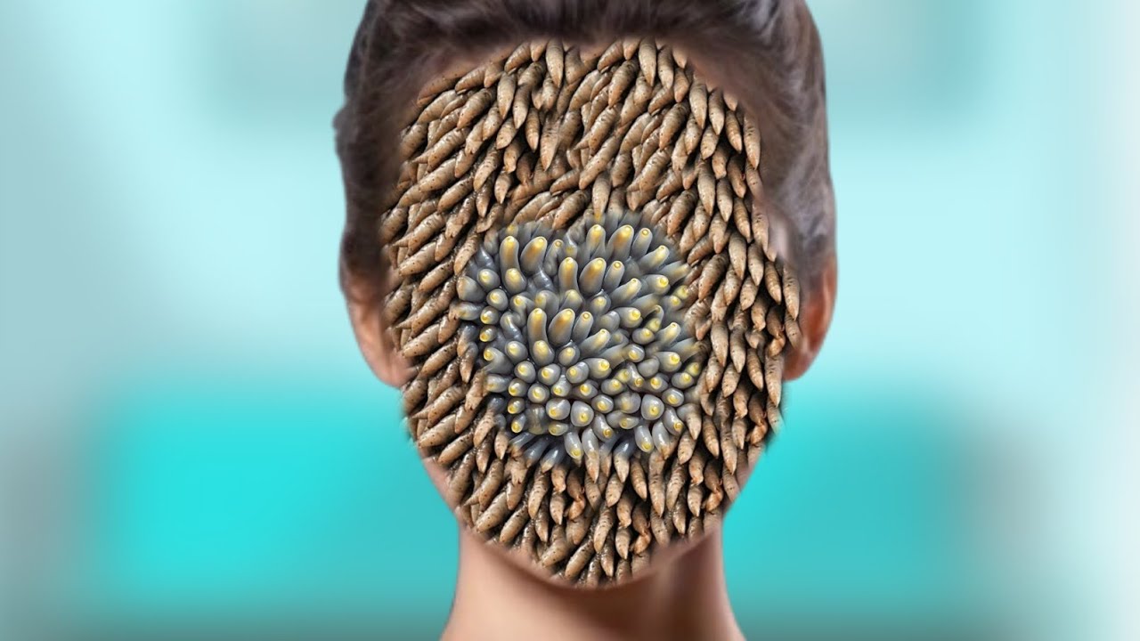ASMR Animation Treatment : Removing Maggots & Ticks From a Woman's Face ...