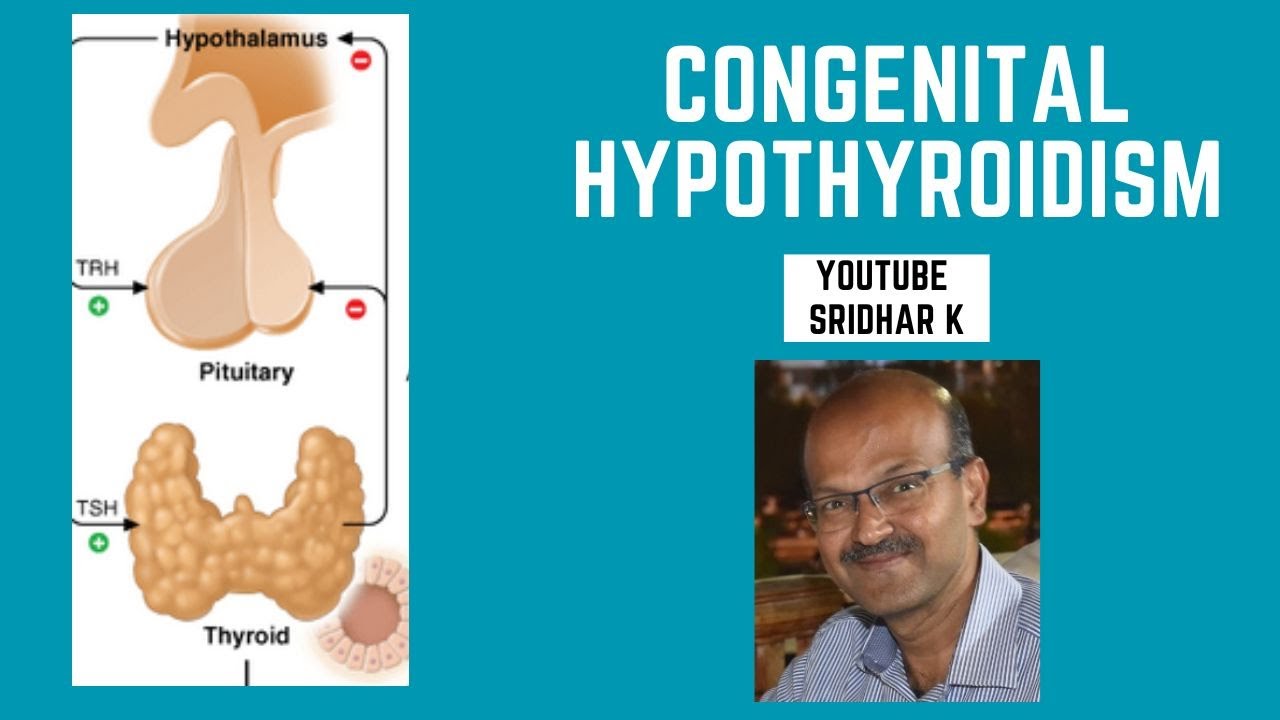 Congenital hypothyroidism-a detailed review #neonatology # ...