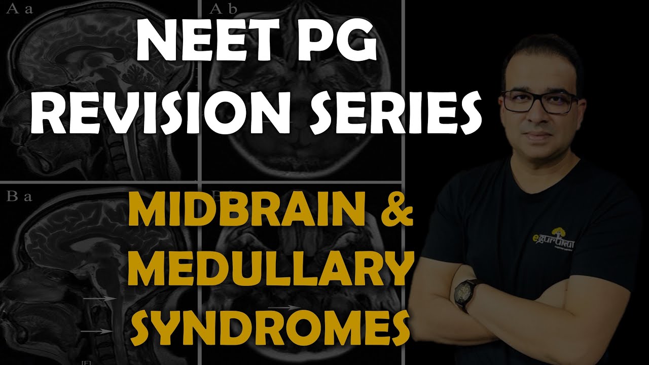 NEET PG- MIB BRAIN & MEDULLARY SYNDROMES - YouTube