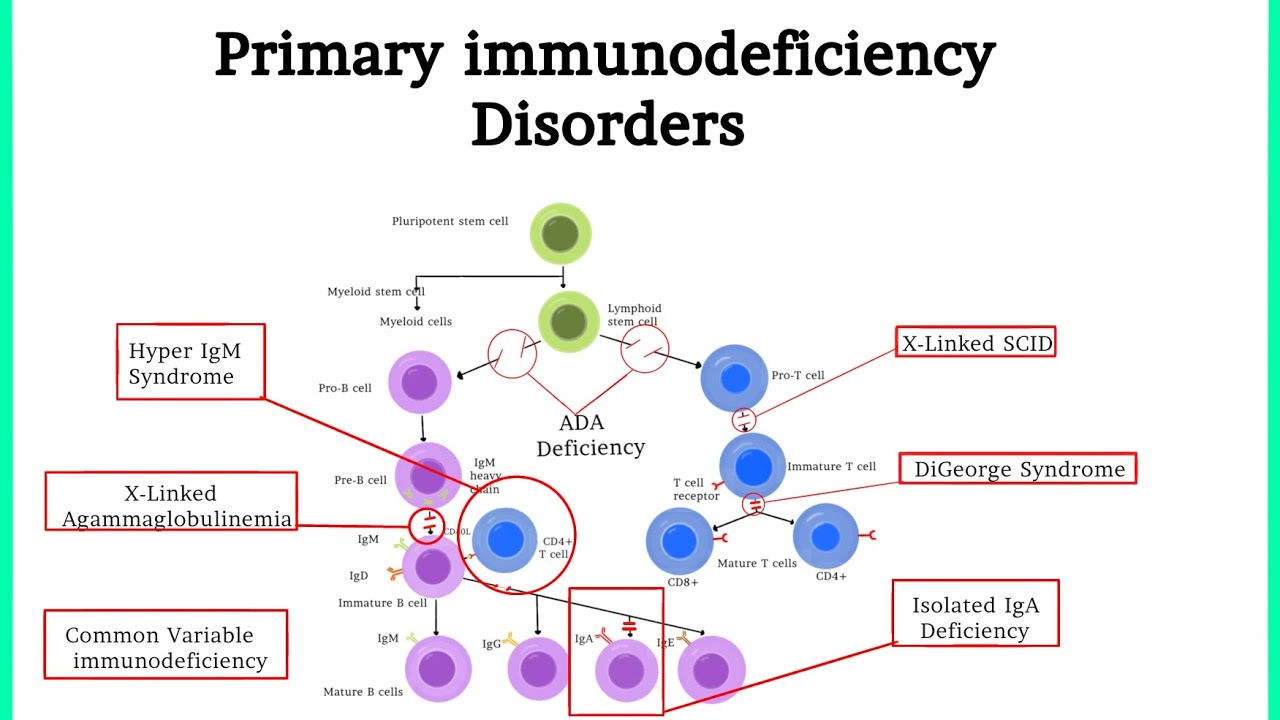 Pathology (40) Primary Immunodeficiency Disorders |Xanuunada hoos u ...