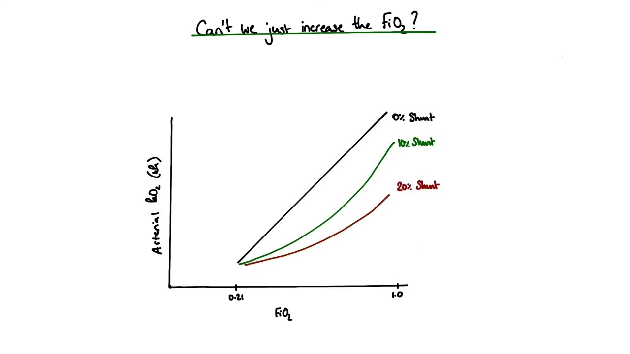 Introduction to Shunt - YouTube