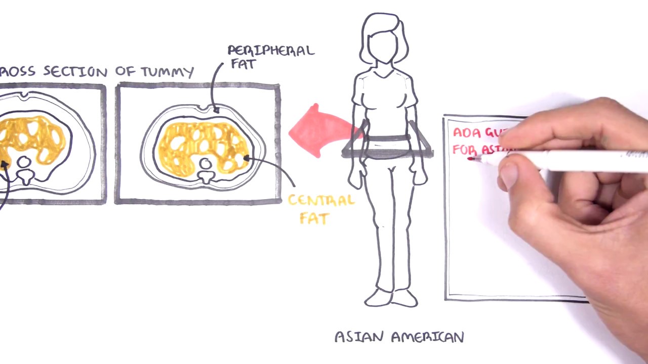 ADA New Diabetes Screening Guidelines YouTube ada-new-diabetes-screening-guidelines-youtube