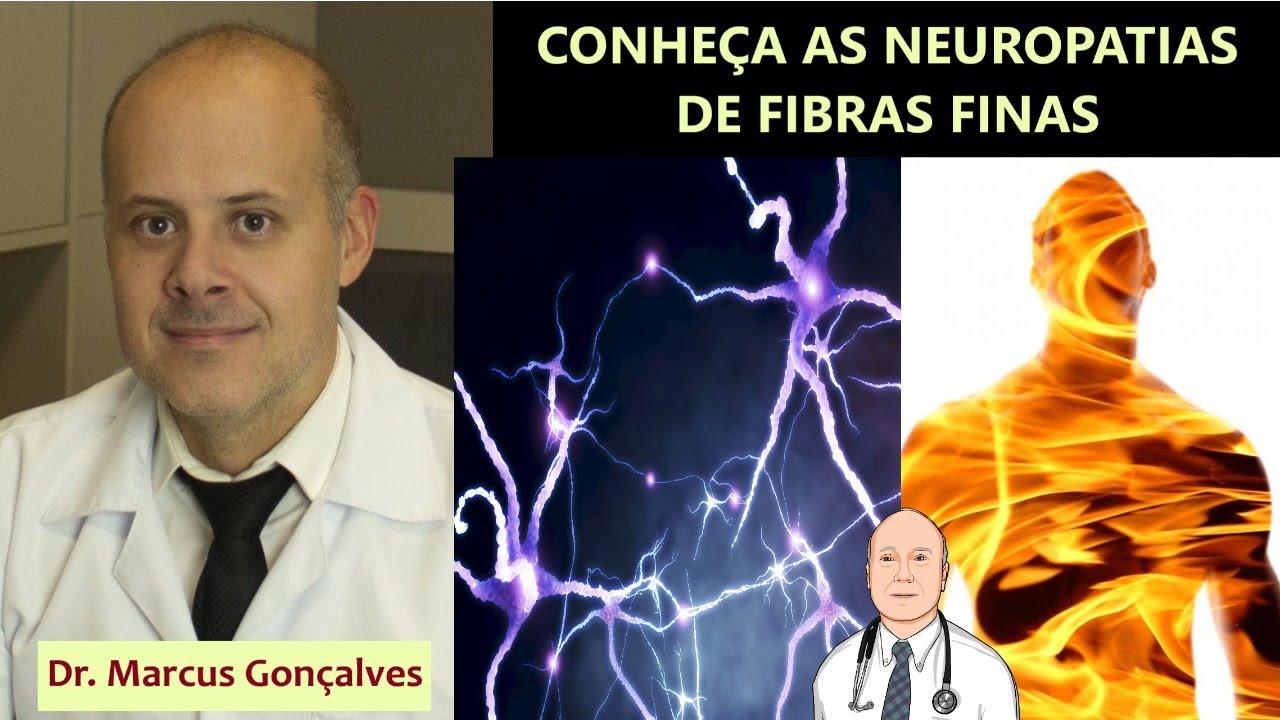 O que é neuropatia de fibras finas? Quais as causas, os sintomas e o ...