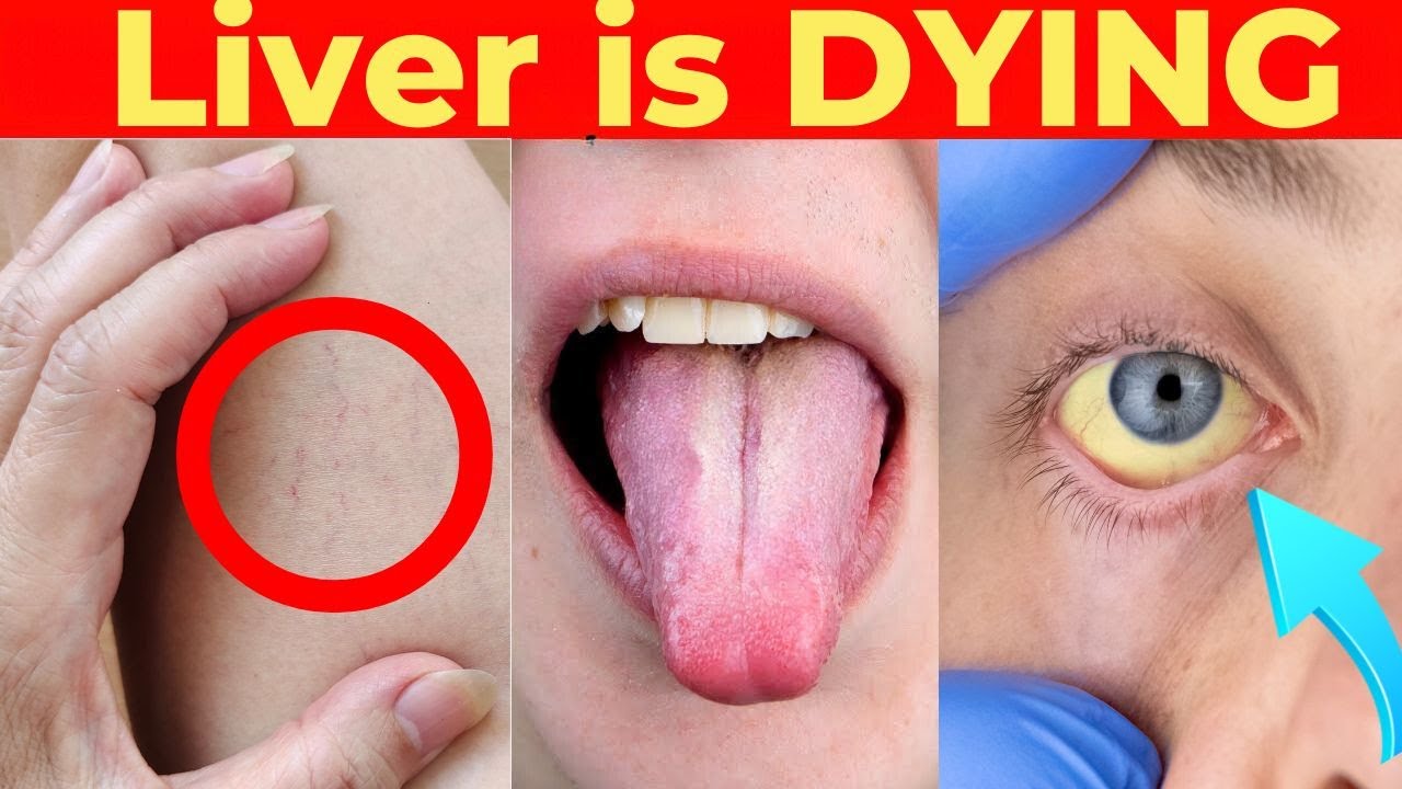 Your liver is crying out for help due to damage. Explore 12 warning ...