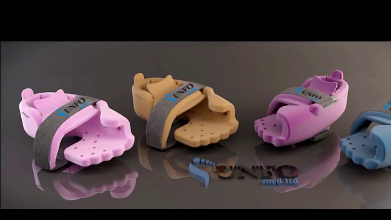 Metatarsus Adductus (Pigeon Toe) Treatment Shoes - UNFO med - YouTube