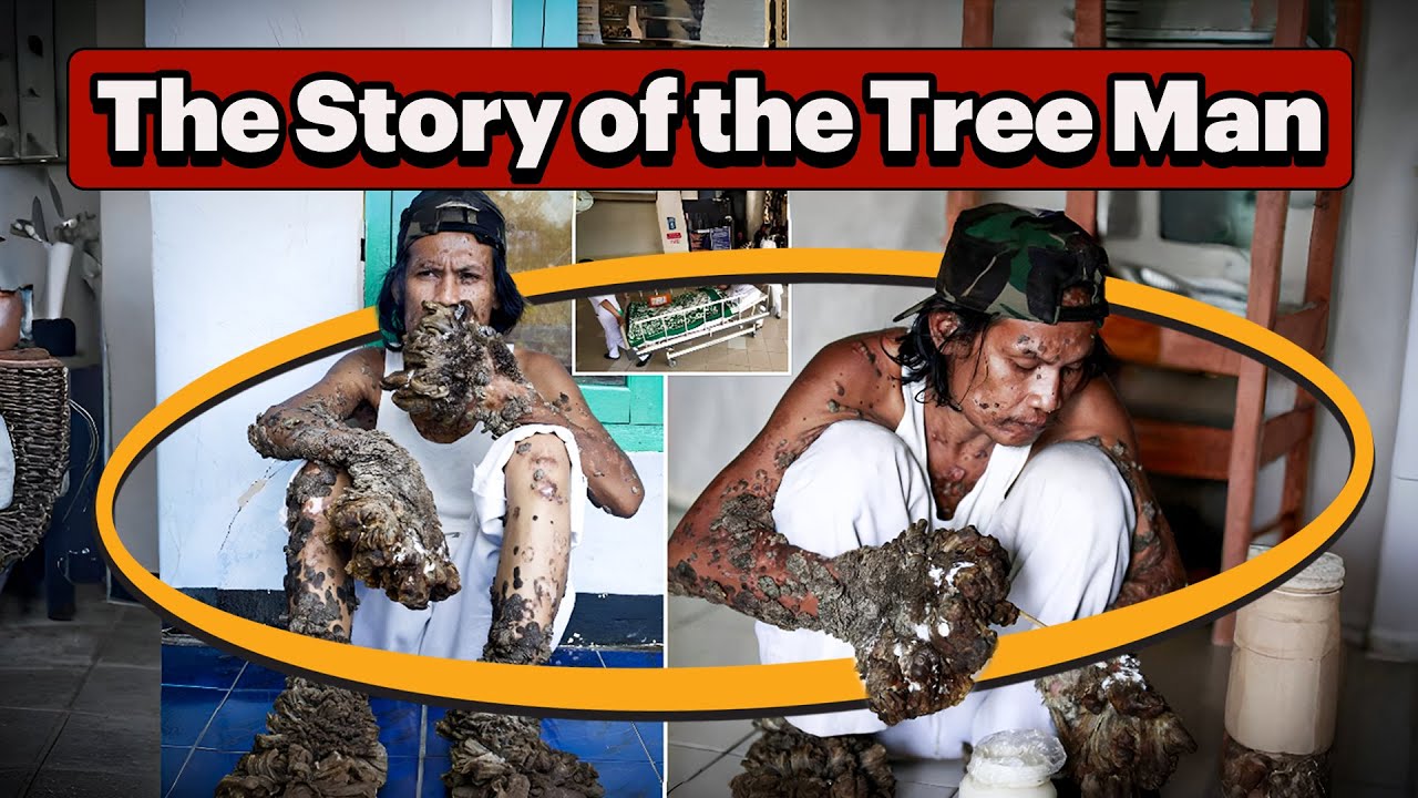 Men Who Turned Into Trees! - YouTube