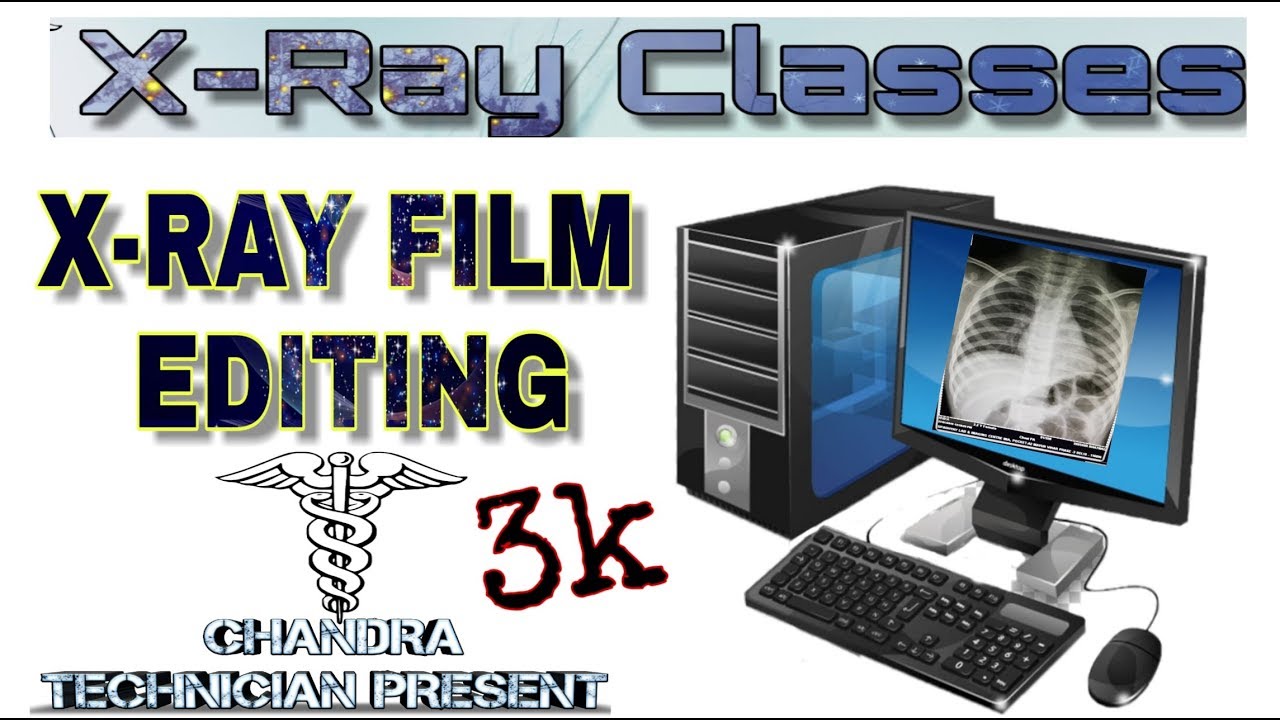 Part 3 X-Ray Film Editing in Coputed Radiography by Chandra Technician ...