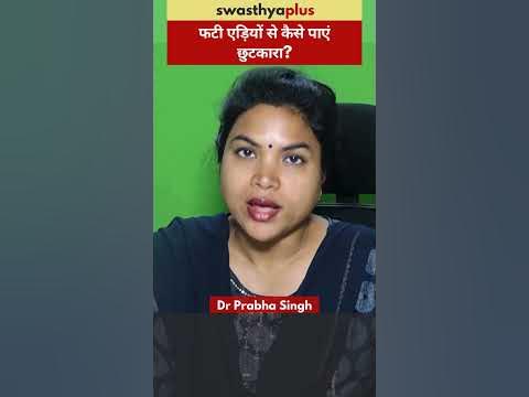 फटी एड़ियों से कैसे पाएं छुटकारा? | Treatment of Crack Heels | Dr Prabha Singh #Shorts - YouTube
