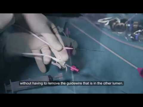 RocaUS® Ureteral Access Sheath by ROCAMED - vfse - YouTube